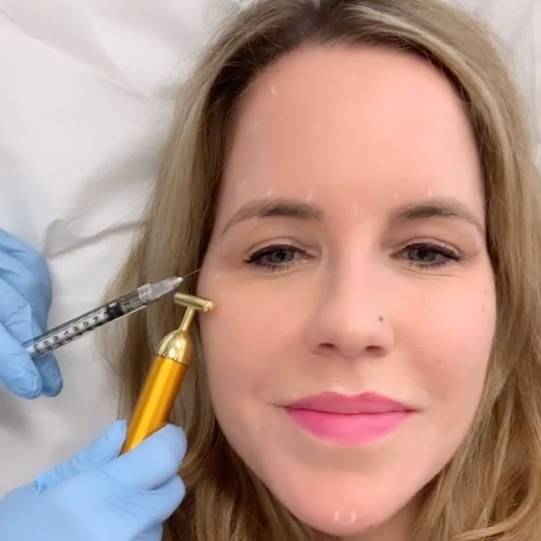 Botox/Dysport, neurotoxins, their history, what are they and how do ...